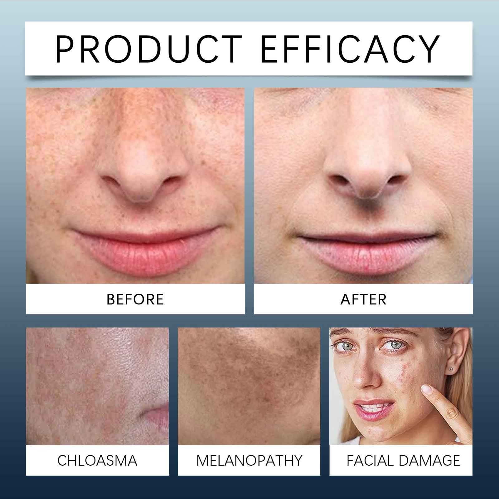 2 Pack Face Cream Set All Day Sun Protection Night with Centella ...