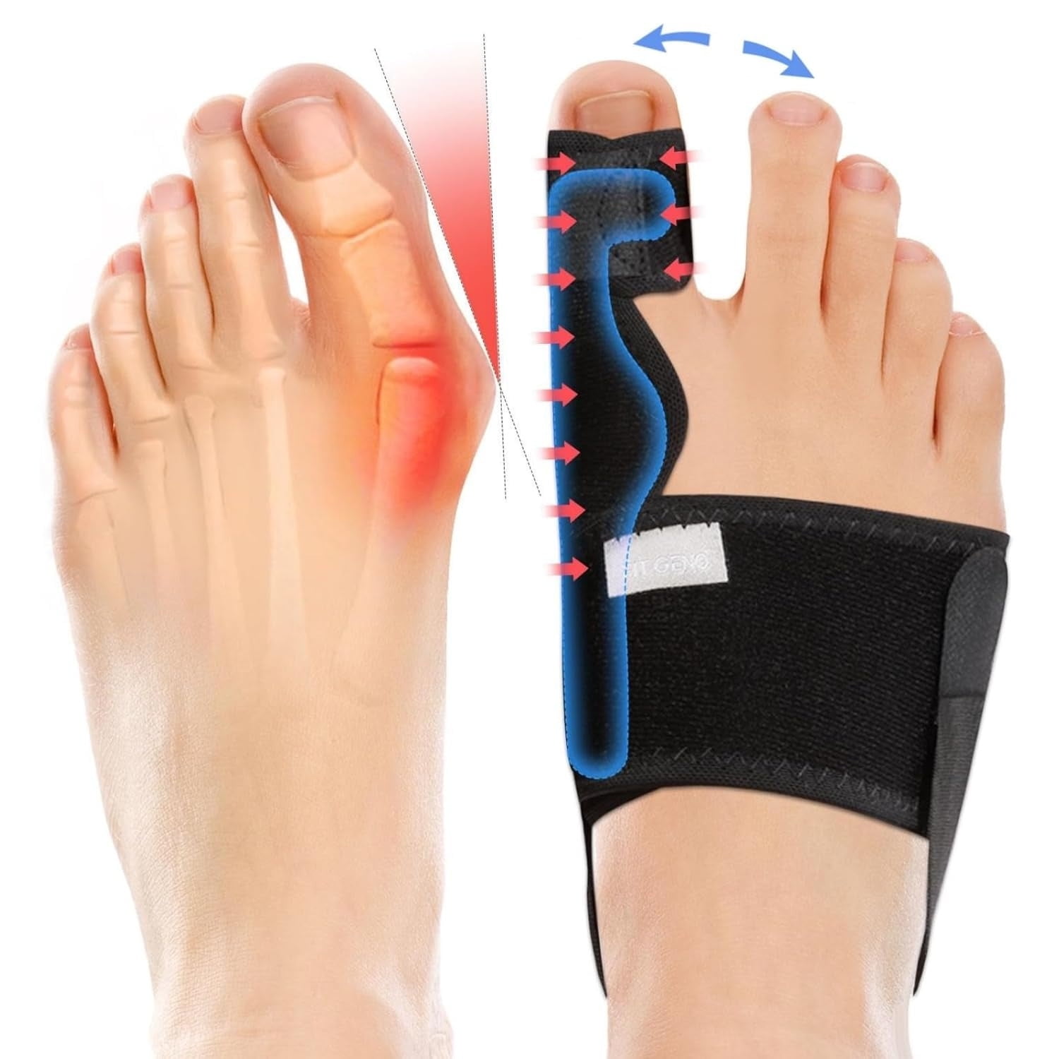 2 Pcs Bunion Corrector for Women & Men Big Toe Straightener-Bunions ...