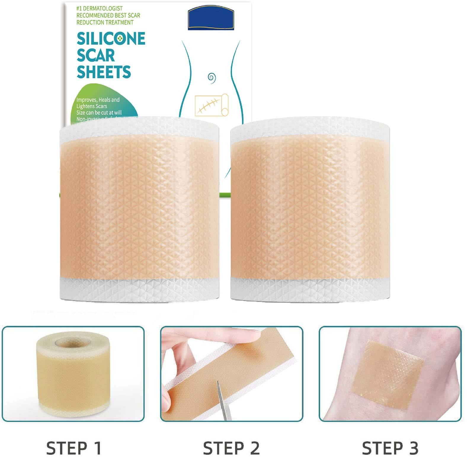 (2 Rolls)1.5" x 118" Silicone Scar Sheets Scar Tape Roll, Scar Removal ...