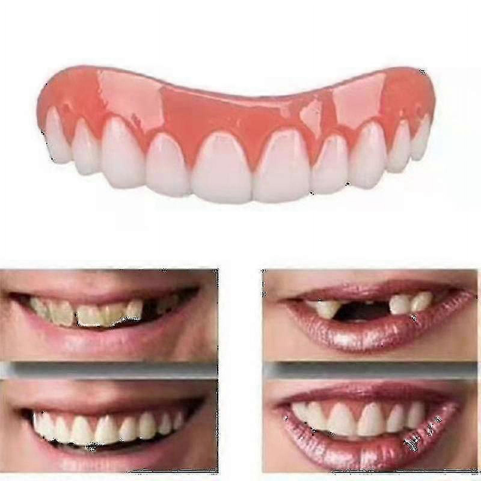 2 Sets Of Dentures, Upper And Lower Jaw Dentures, Natural And ...