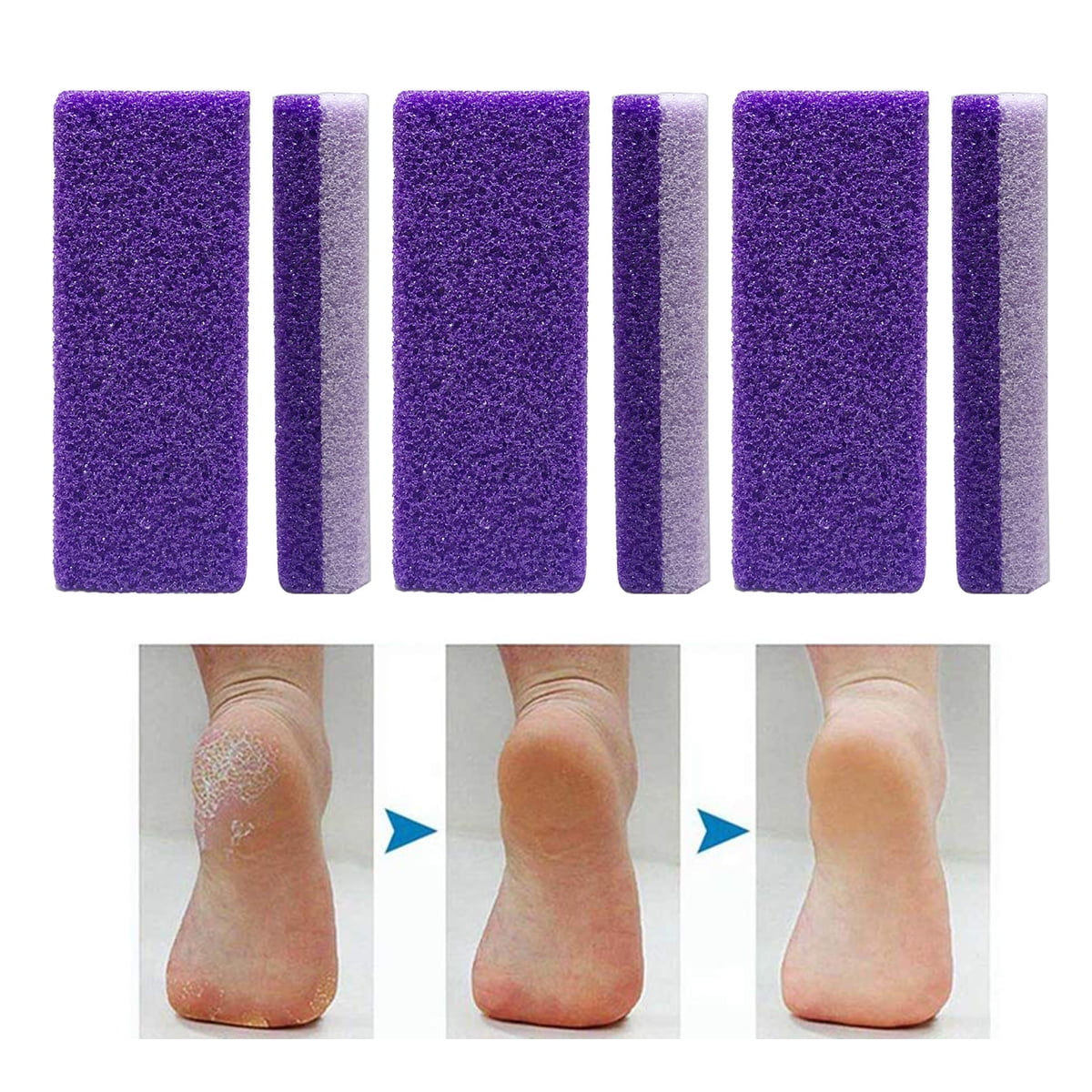 2 in 1 Pumice Stone for Feet, Callous Remover, Dead Skin Remover for ...