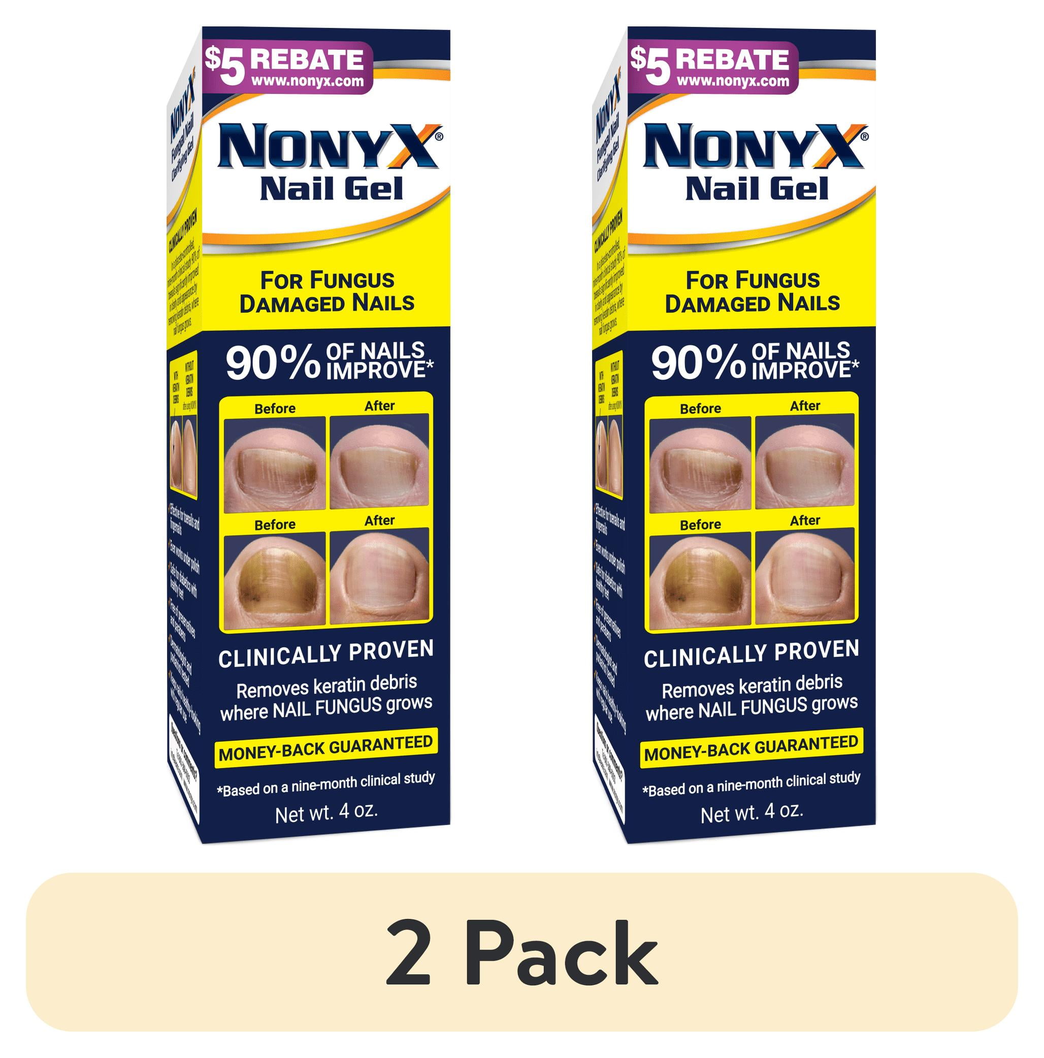 (2 pack) Nonyx Nail Gel Restores Fungus Damaged Nails, a Clinically ...