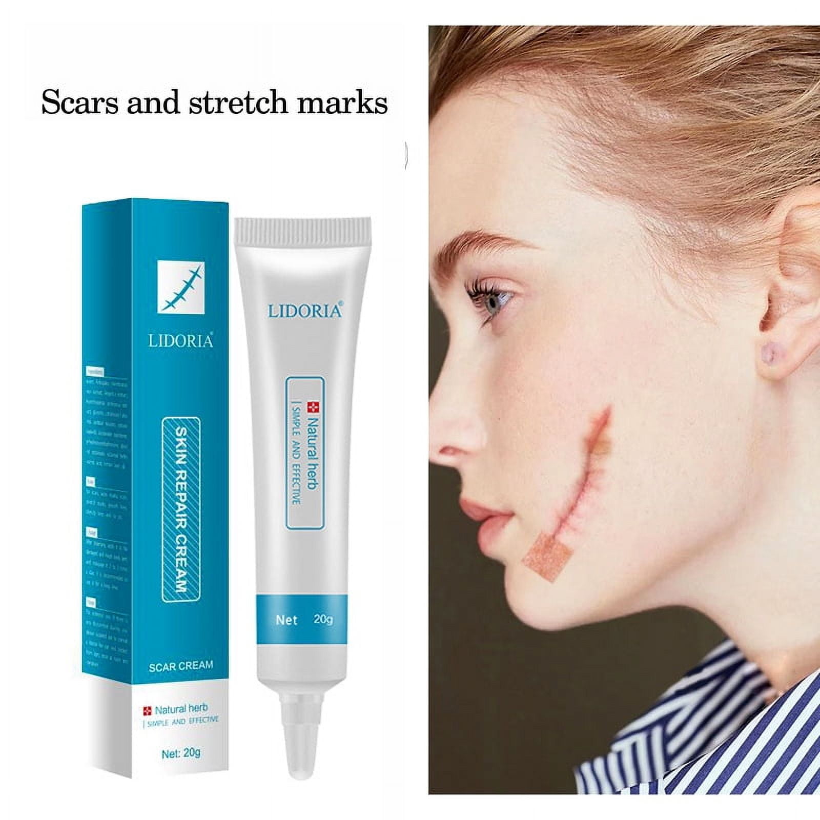 2 pieces Scar Repair Cream Acne Scars Remove Gel Fade Stretch Marks ...