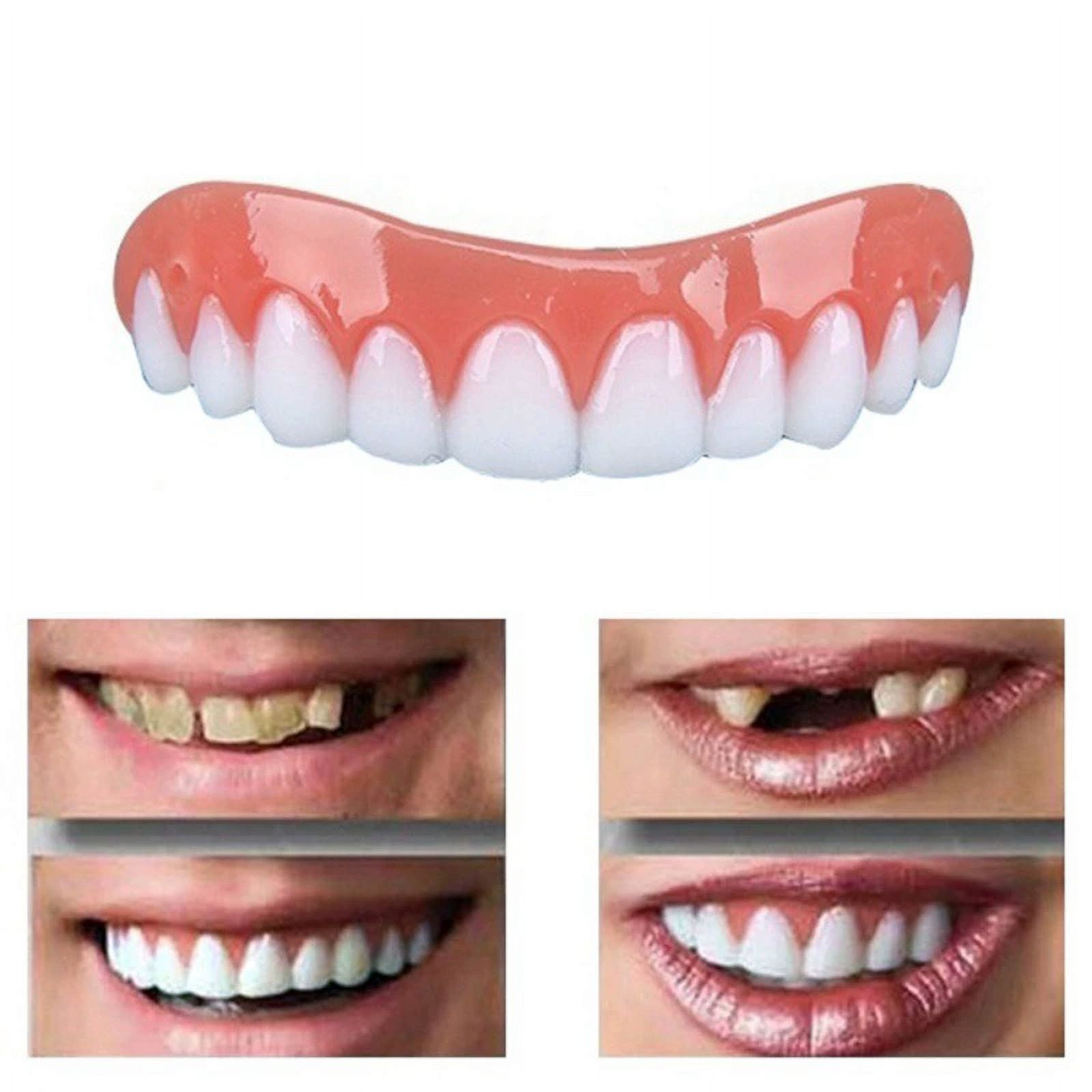 2 sets of dentures, upper and lower jaw dentures, natural and ...