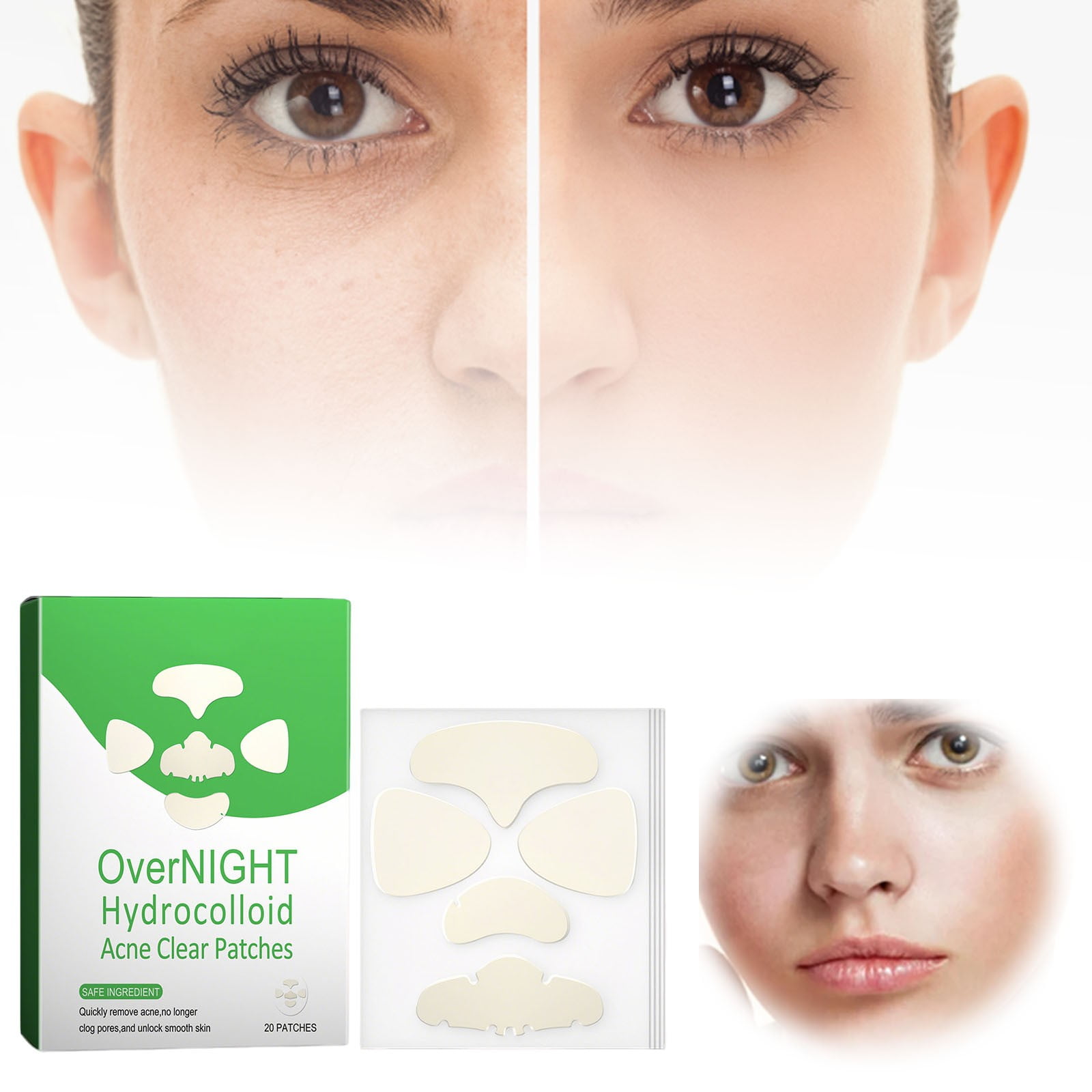 20 Count Pimple Patches for Face, Hydrocolloid Acne Patch Bulk, Acne ...