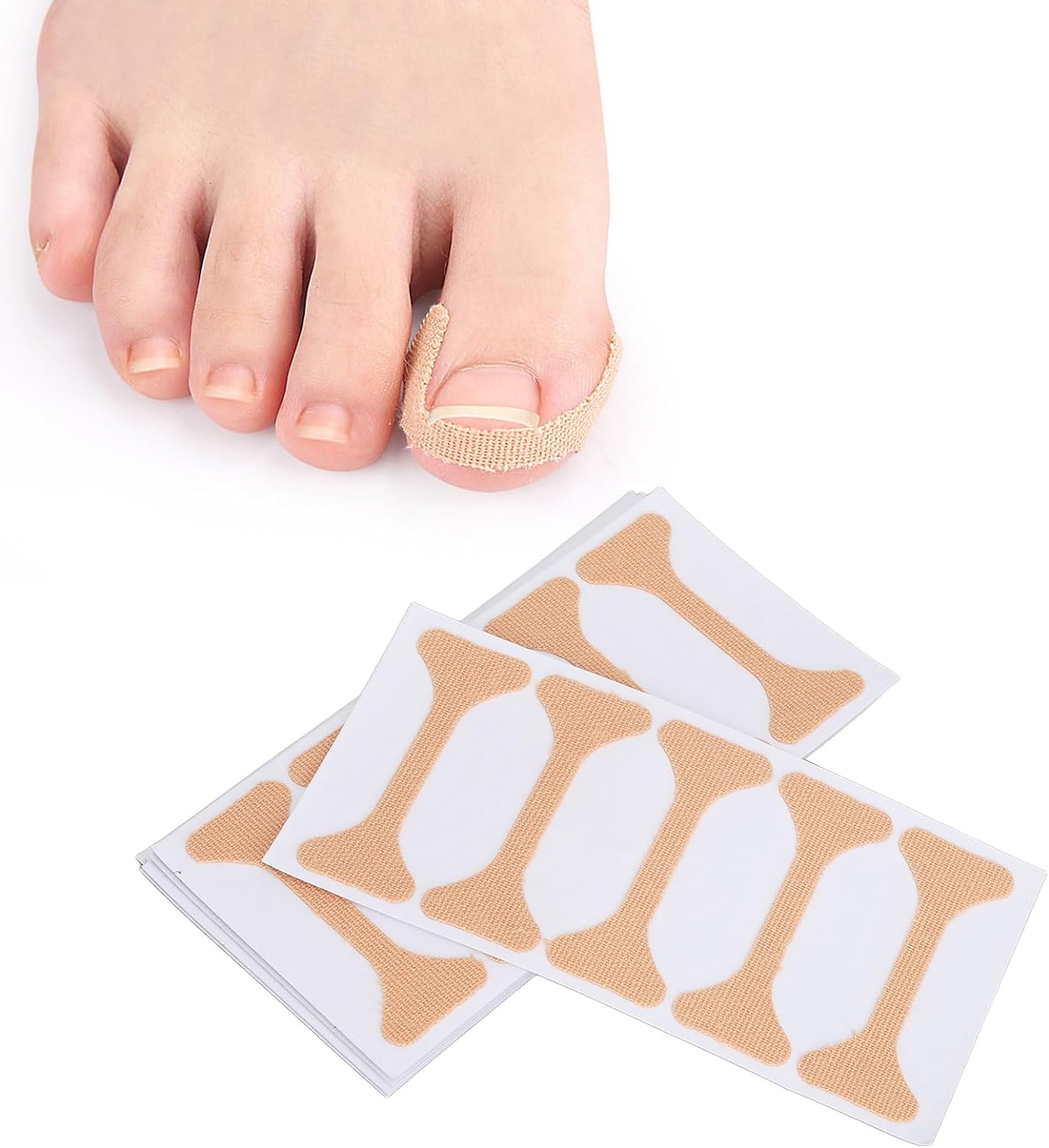 20 Sheets Ingrown Toenail Treatment, Painless Ingrown Toenail Tool ...