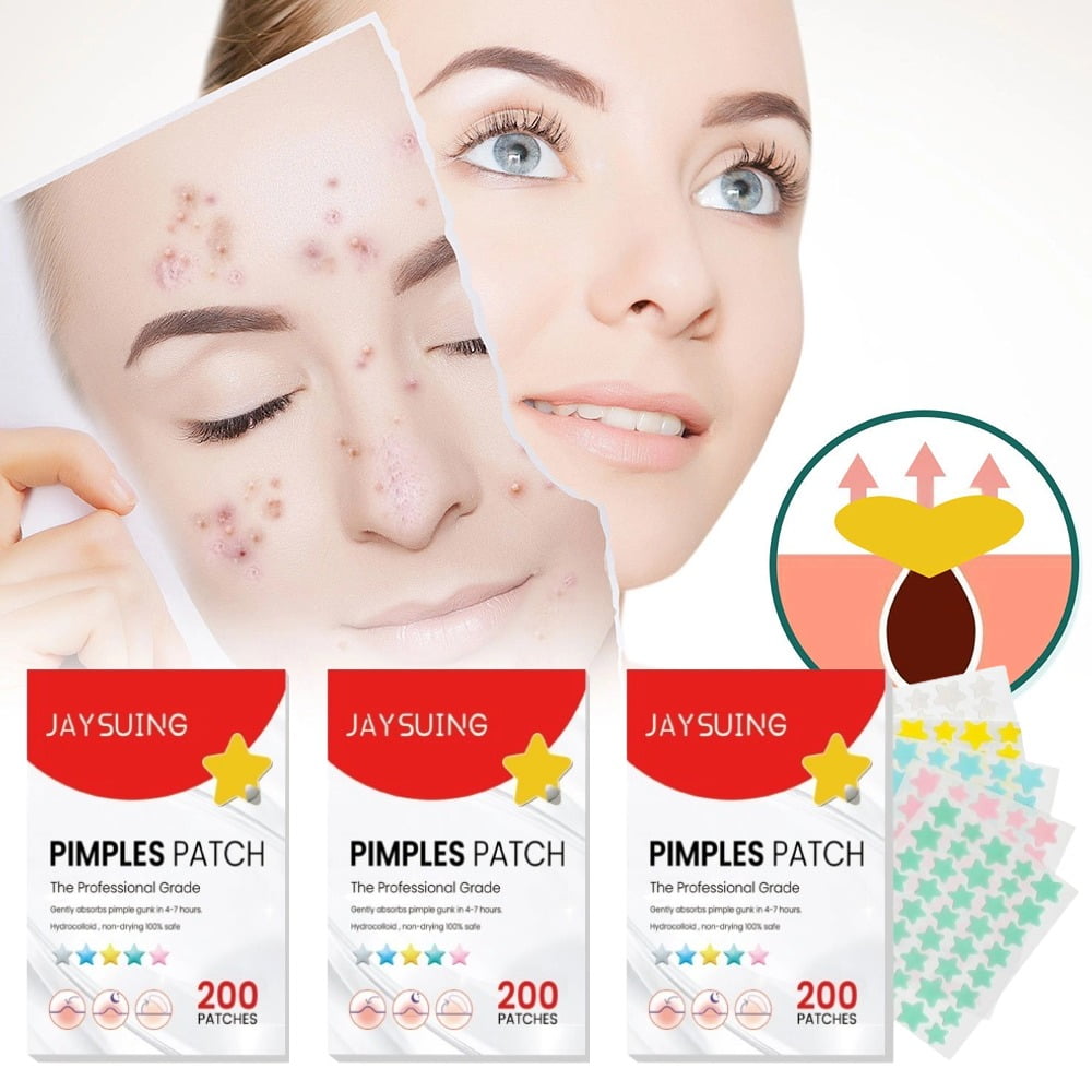 200 Counts Star Acne Patches, Star Pimple Patch Pimple Patches for Face ...