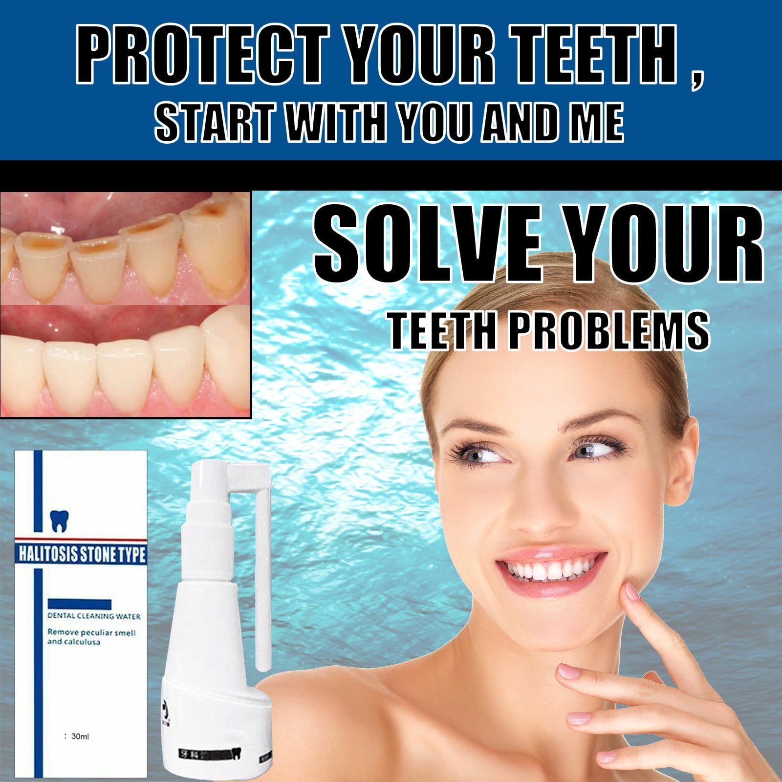 2024 Newest CalculusFree Dissolving Tooth Spray Brightify Deep Cleaning ...