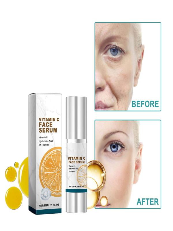 2025 30ml Total Package Serum, All-In-One Vitamin C, Hyaluronic Acid ...