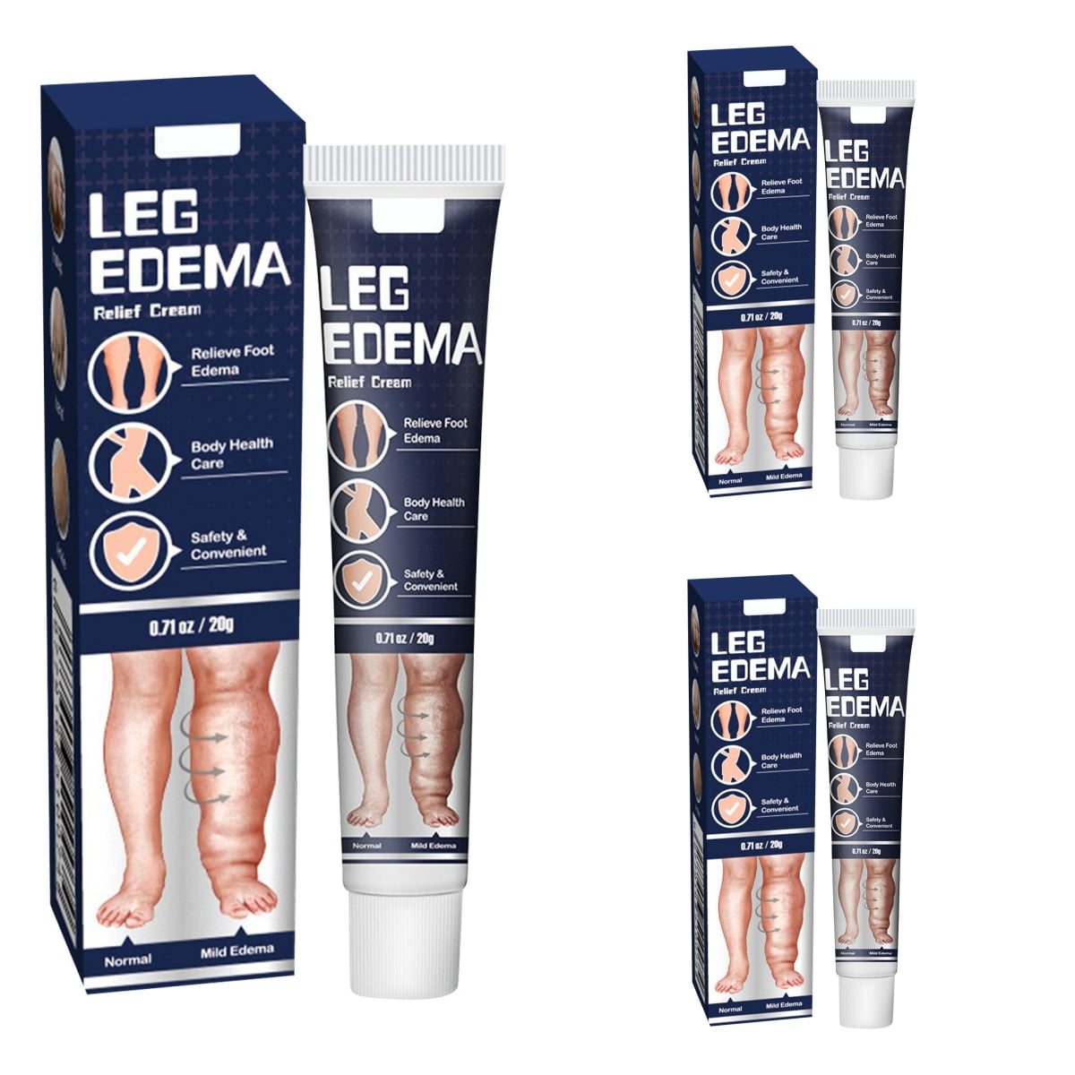 2025 Anti-edema Cream Leg Swelling Edema Cream Arm Calf Foot Massage ...