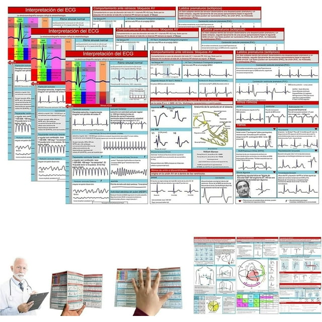 2025 Brand New EKG Pocket Guide,EKG Rhythm Interpretation,Compact ... 2025 Brand New EKG Pocket Guide,EKG Rhythm Interpretation,Compact ...