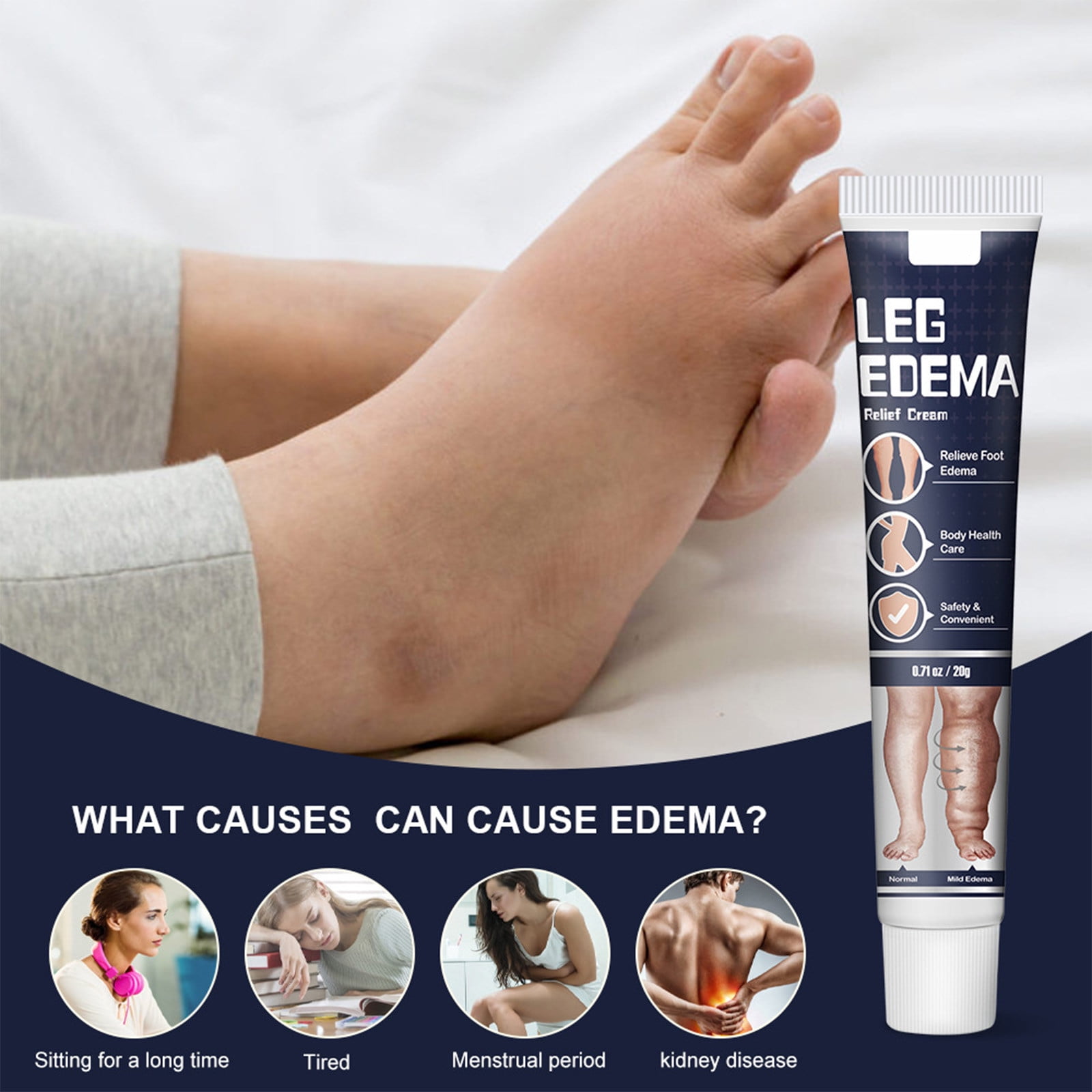 2025 CHOII Anti-edema Cream Leg Swelling Edema Cream Arm Calf Foot ...