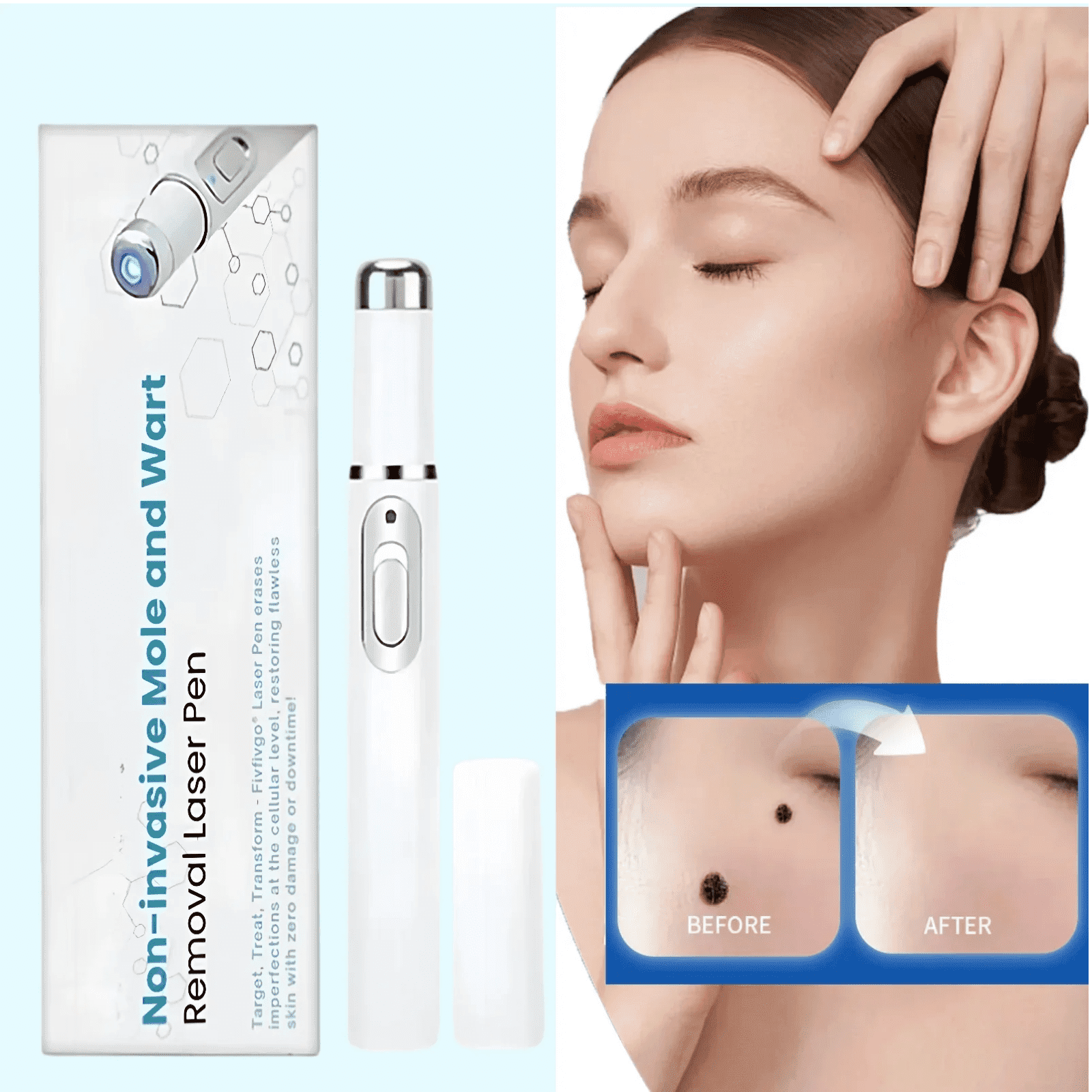 2025 New Non-Invasive Mo*le and Wa*rt Re*mov*al Laser Pen, Advanced ...