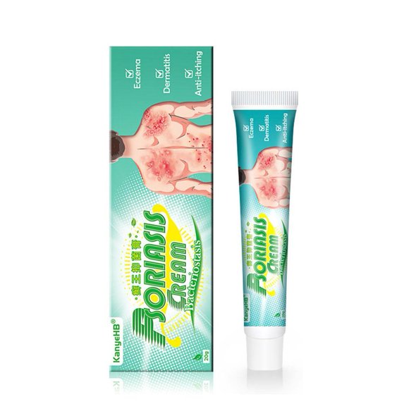 Ringworm Treatment Creams