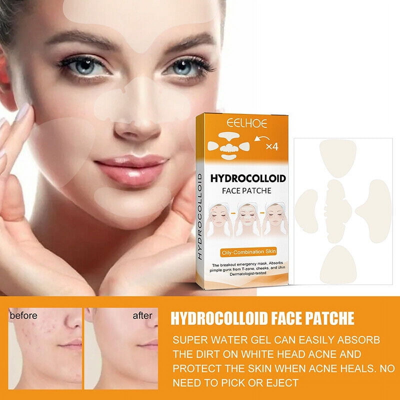 20pcs Hydrocolloid Patches FaceMask Acne Pimple Zit For Nose Chin ...