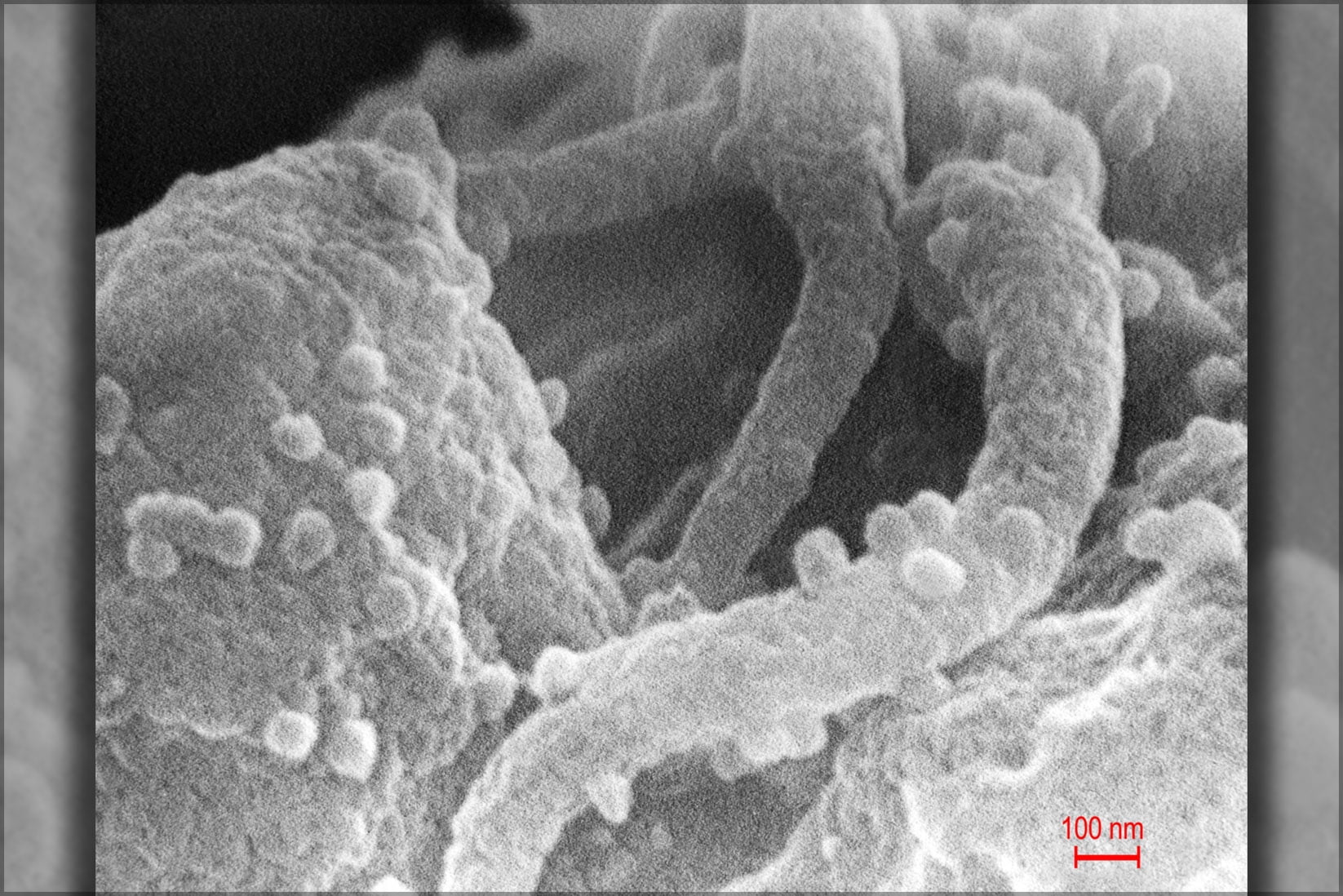 24"x36" Gallery Poster, scanning electron microscope image hiv aids ...