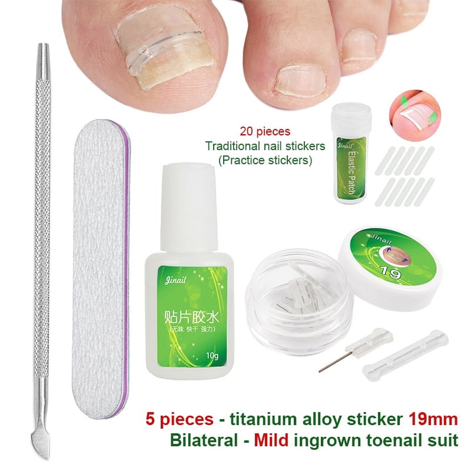 25/30Pcs 13-19mm Nail Correction Stickers Ingrown Toenail Corrector ...