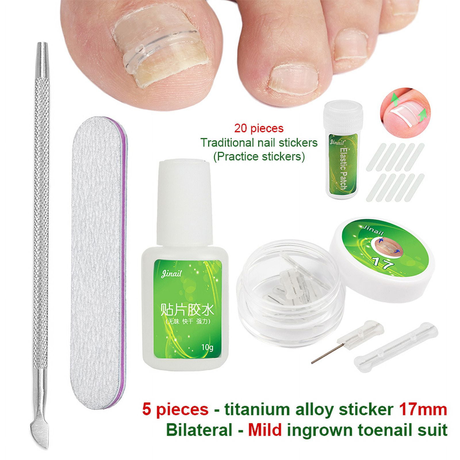 25/30Pcs 13-19mm Nail Correction Stickers Ingrown Toenail Corrector ...