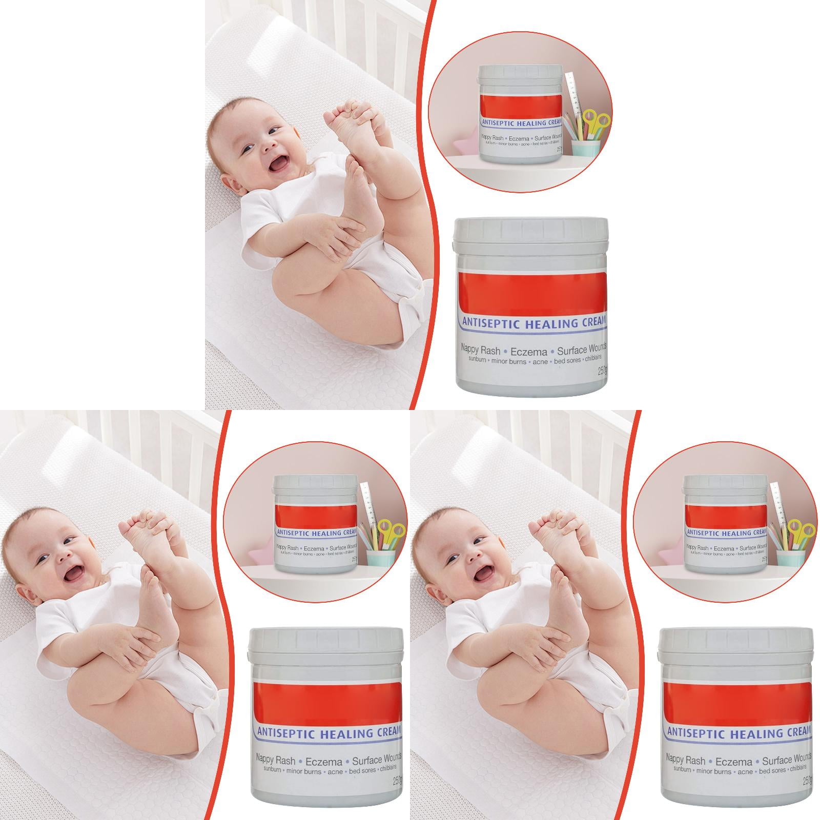 250g Children’s Skin Relief-Soothing Cream for Rash, Cuts, Sunburn ...