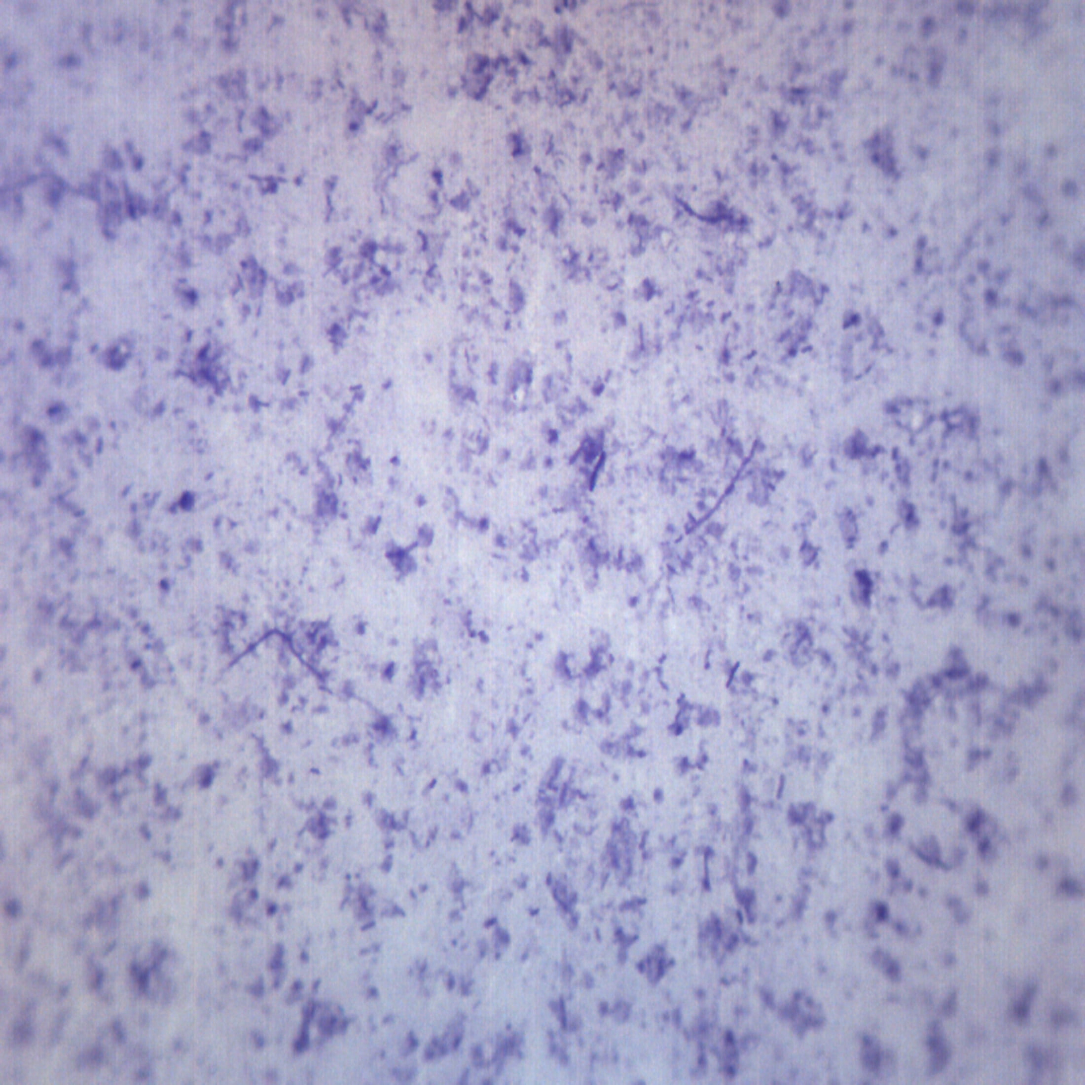 25PK Bacillus Culture, Gram Positive & Negative - Prepared Microscope ...