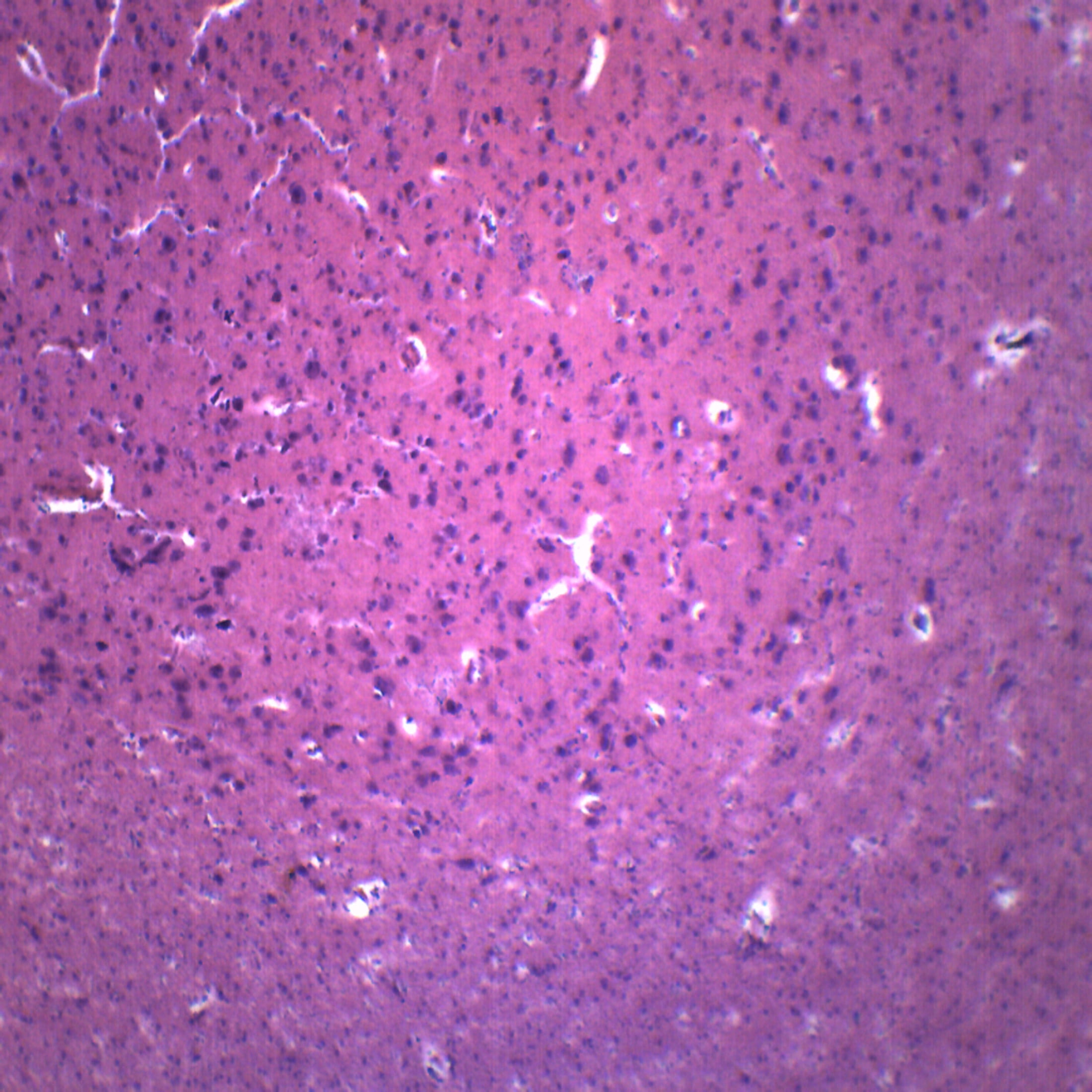 25PK Brain Section, Mammal - Prepared Microscope Slides - Classroom ...