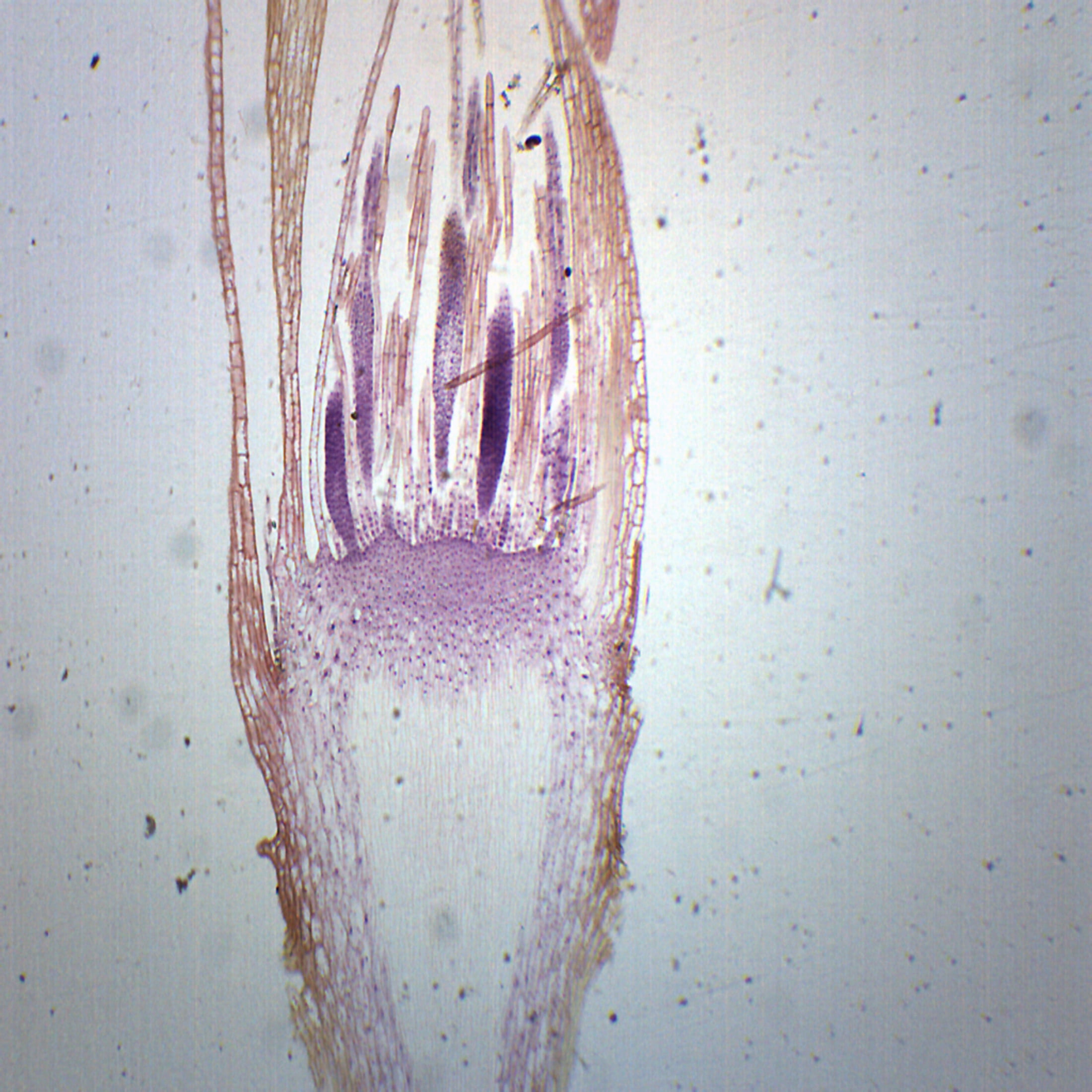 25PK Moss Archegonia - Longitudinal Section - Prepared Microscope ...