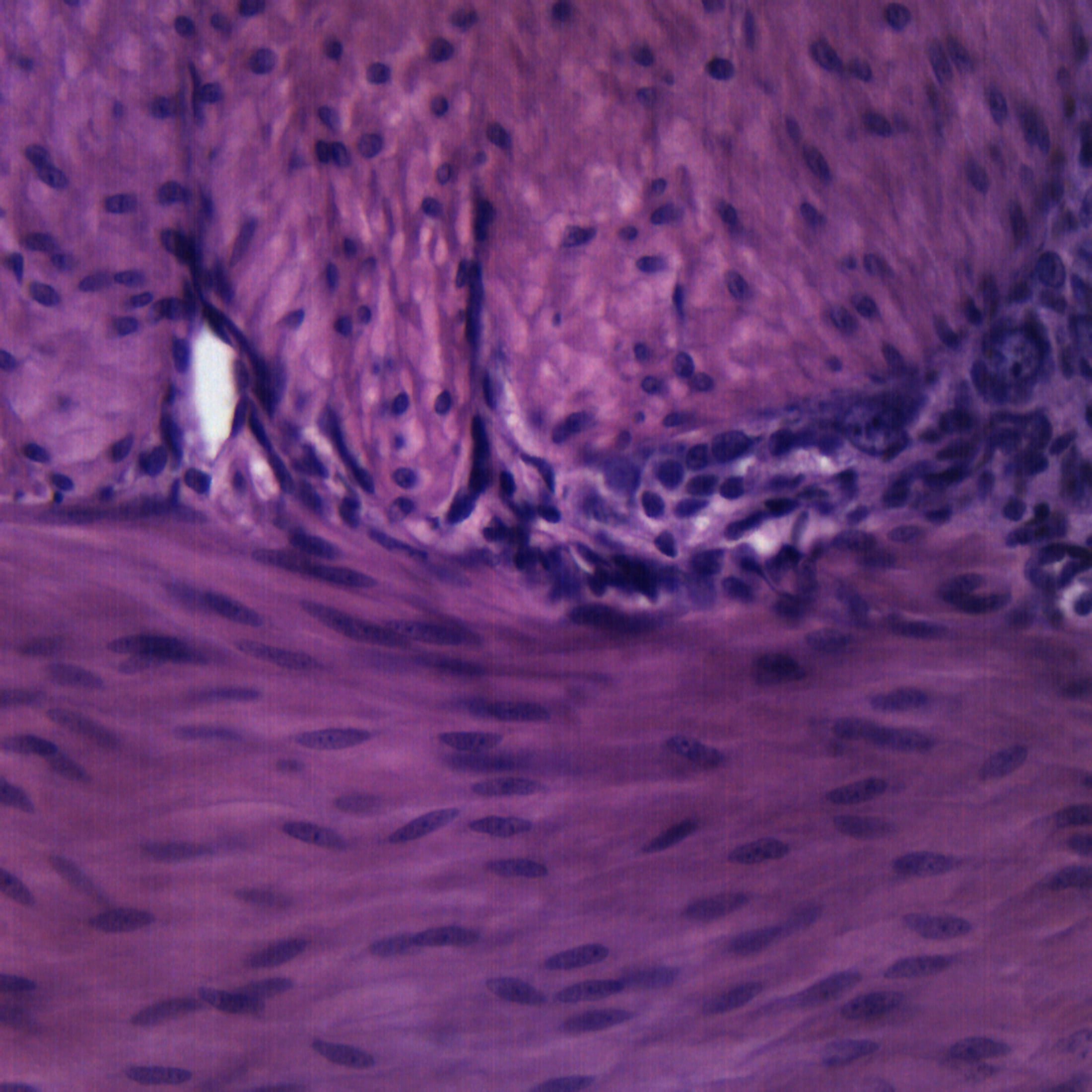 25PK Smooth Muscle Mammal - Cross Section - Prepared Microscope Slides ...