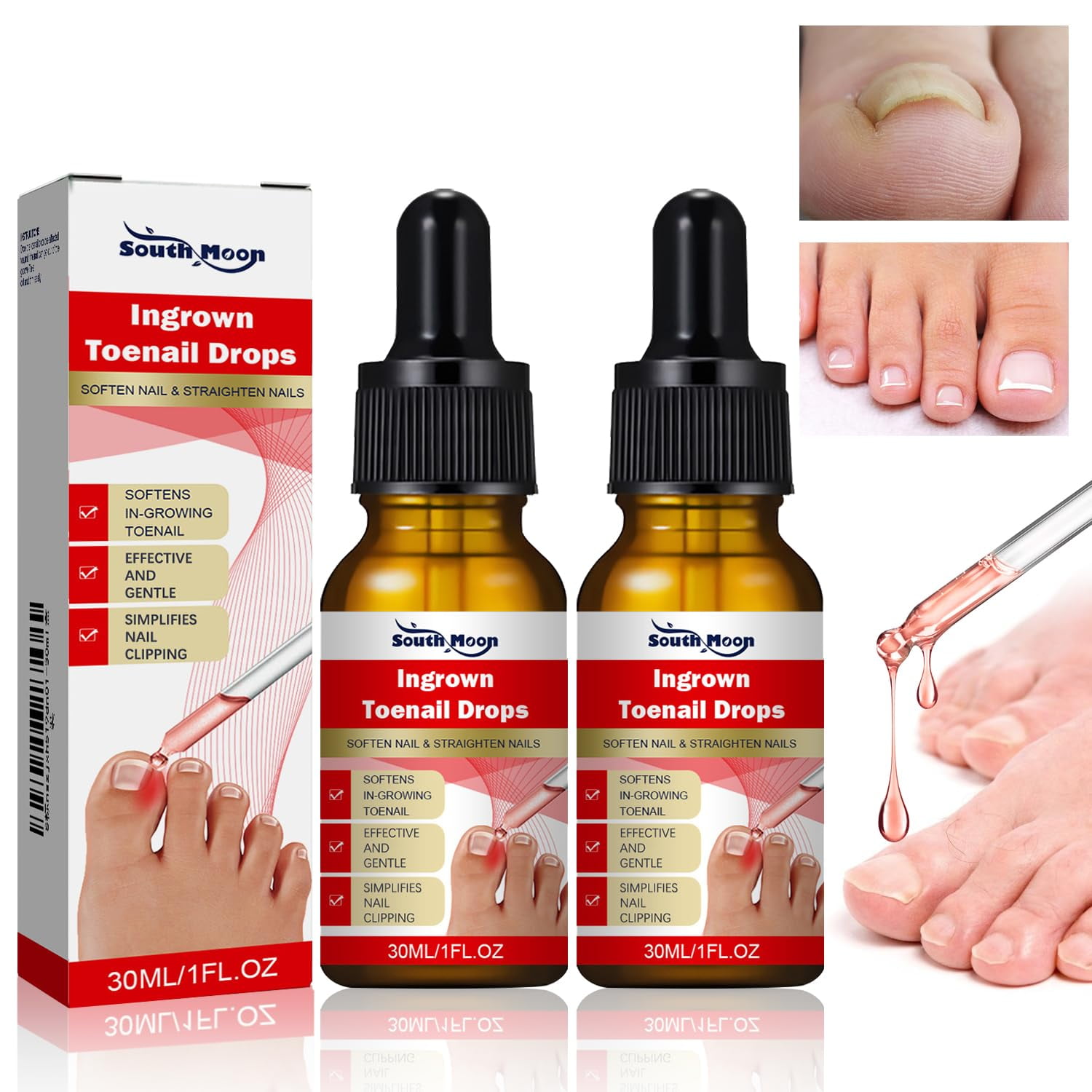 2Ingrown toenail drops, ingrown toenail relief, easy tool for trimming ...