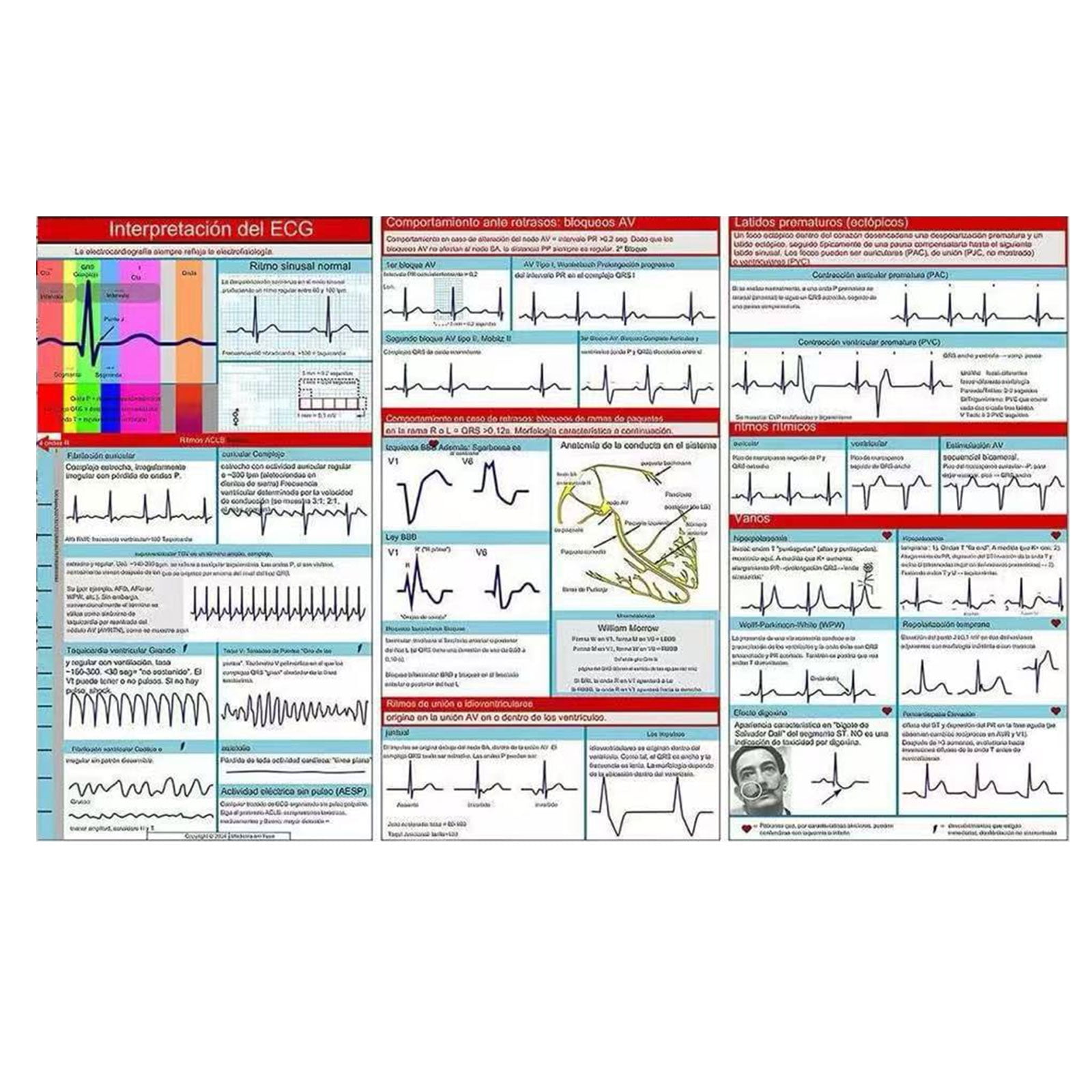 2PCS EKG Pocket Guide - 2025 New Rapid Interpretation of EKG's, EKG ...