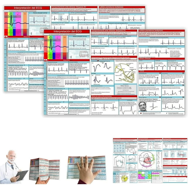 2PCS EKG Pocket Guide,EKG Rhythm Rapid Interpretation Card,Double Sided Compact Portable EKG ...