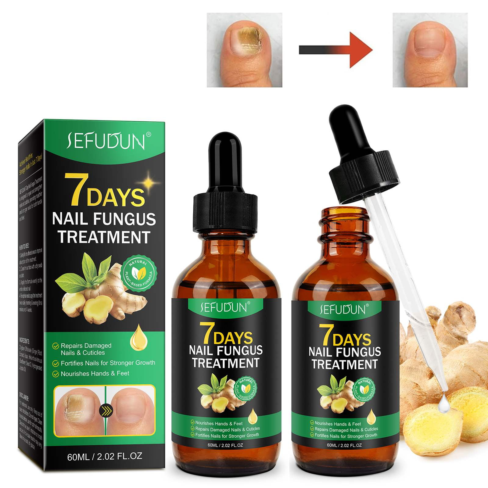 2PCS Ginger Cuticle Care Oil for Nails by Sefudun,Nail Treatment ...