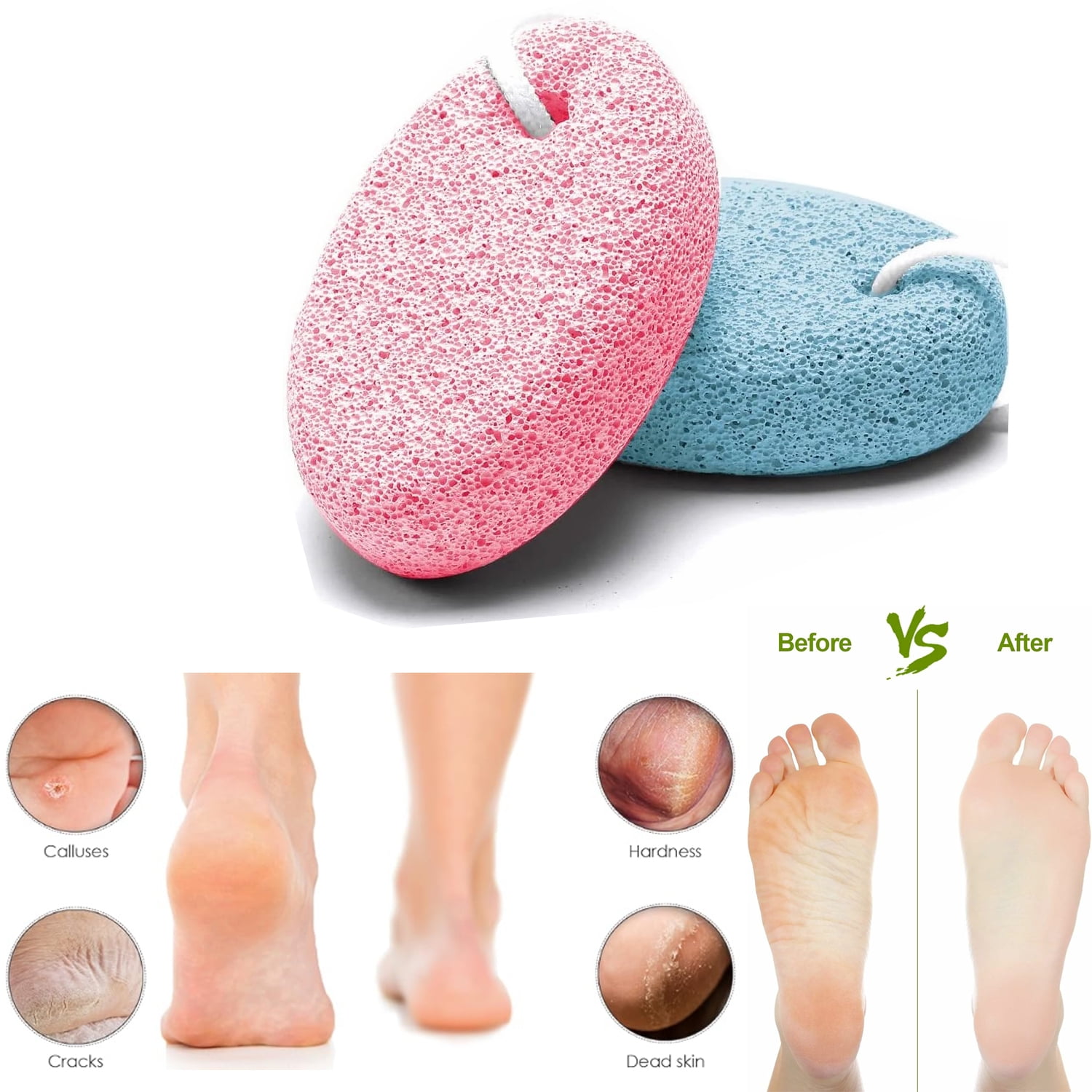 Rongsi Natural Pumice Stone 2PCS Foot Hand Callus Remover Exfoliation ...