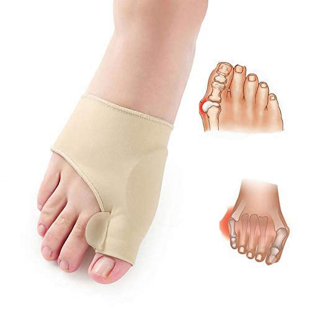 2Pcs/1Pair Medical Bunion Corrector - Toe Orthotics for Feet ...