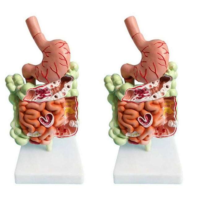 2X Human Digestive System Model Stomach Anatomy Large Intestine Cecum ...