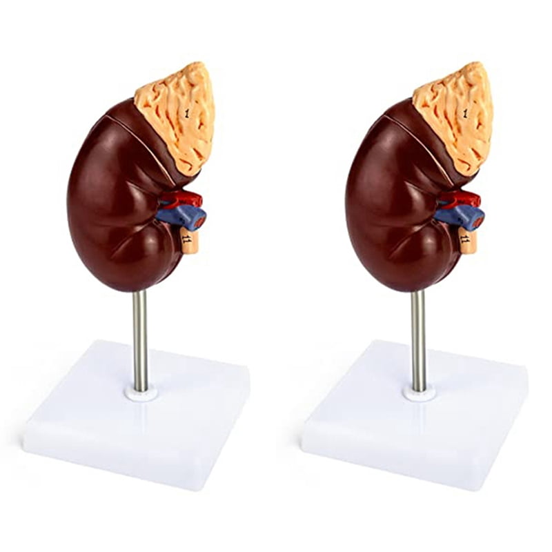 2X Life-Size Kidney Model, 2 Parts Showing Internal Structure A Kidney ...