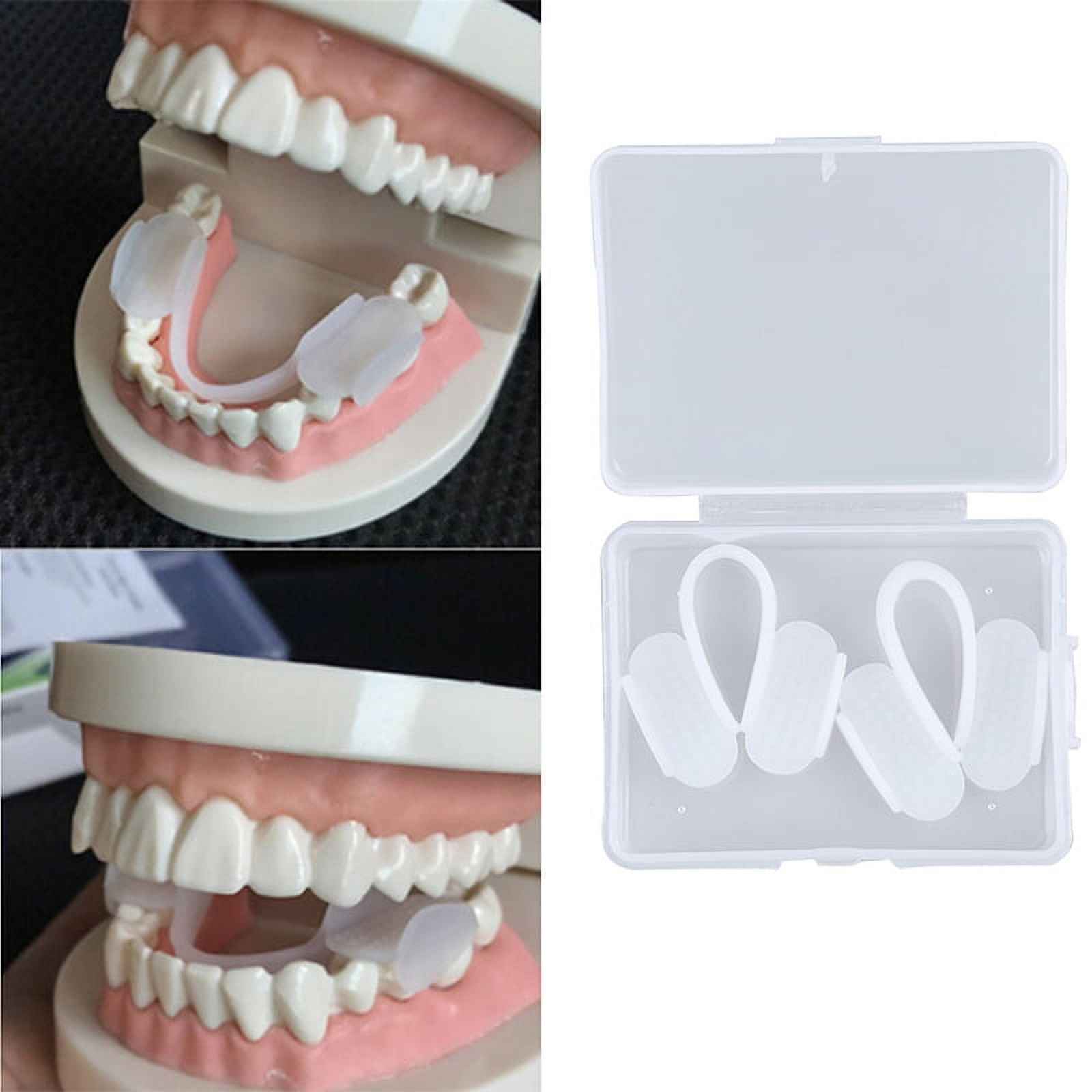 Mouth Splint For Bruxism