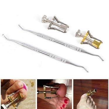 OTVIAP Ingrown Toenail Fixer Adjustable Toe Nail Paronychia Corrector ...