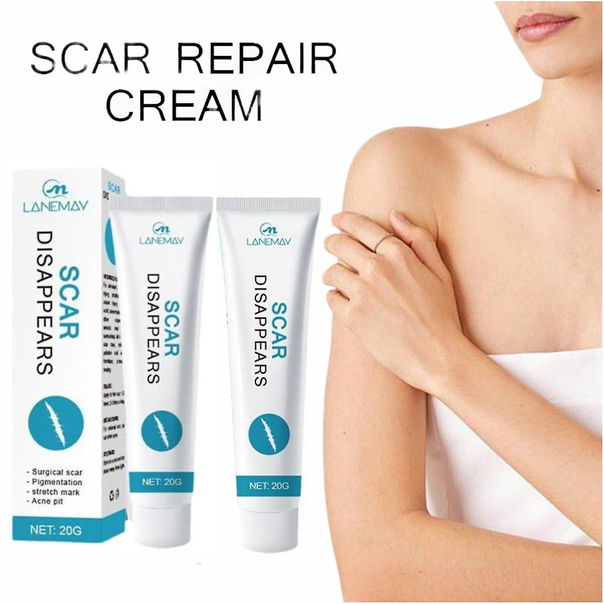 2pcs New Scar Removal Cream Repair Stretch Marks Burn Acne Surgical Acne Scar Ointment Herbal ...