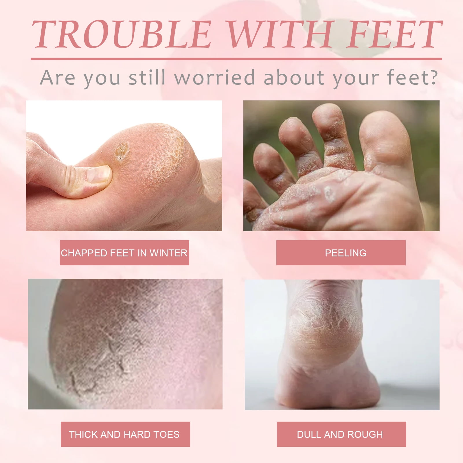 2pcs Peach Foot Mask Moisturizes And Hydrates Feet Smooth, Tender Skin ...