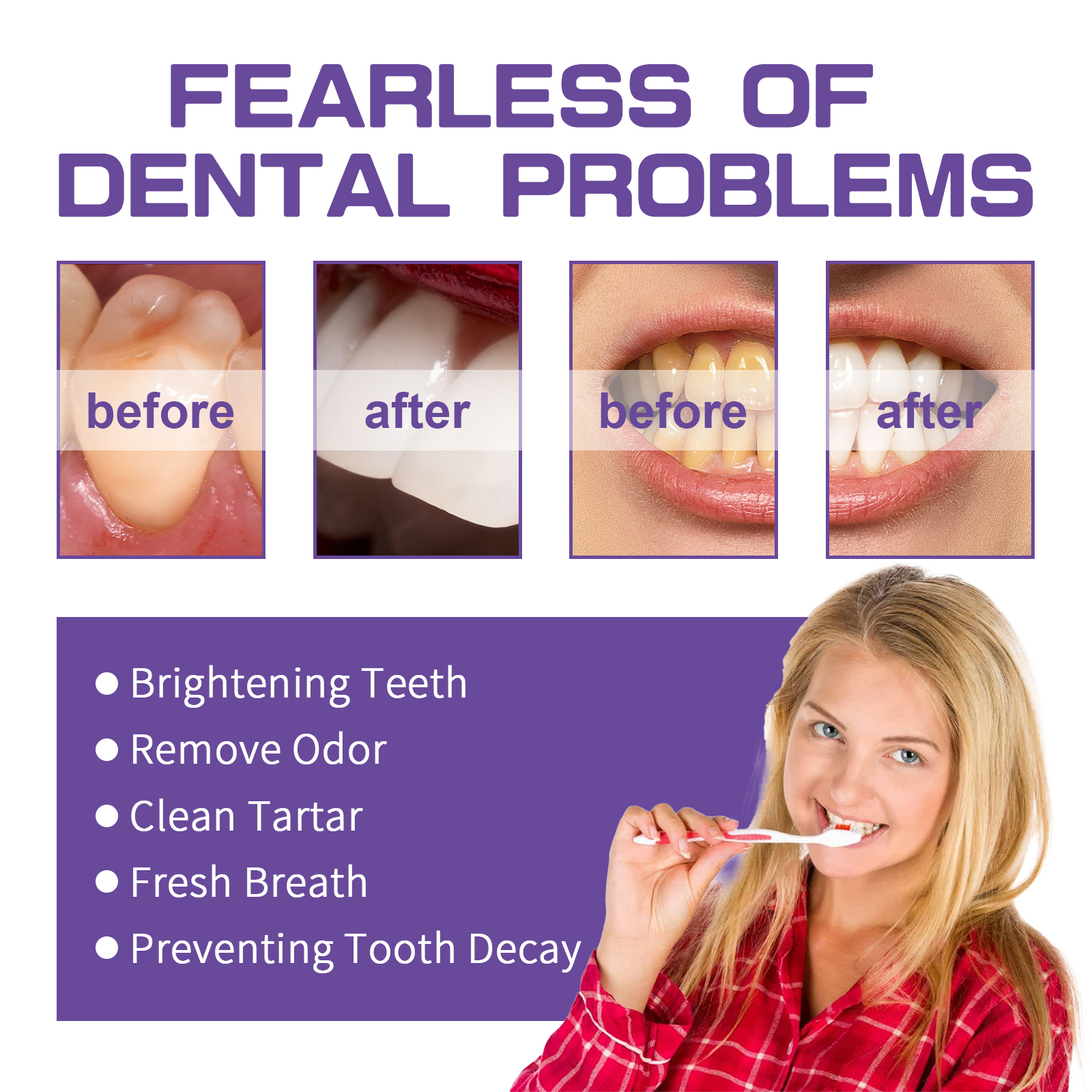 2pcs Plant-Based Tooth Whitening Gel, Clean The Tartar Very Well Tartar ...