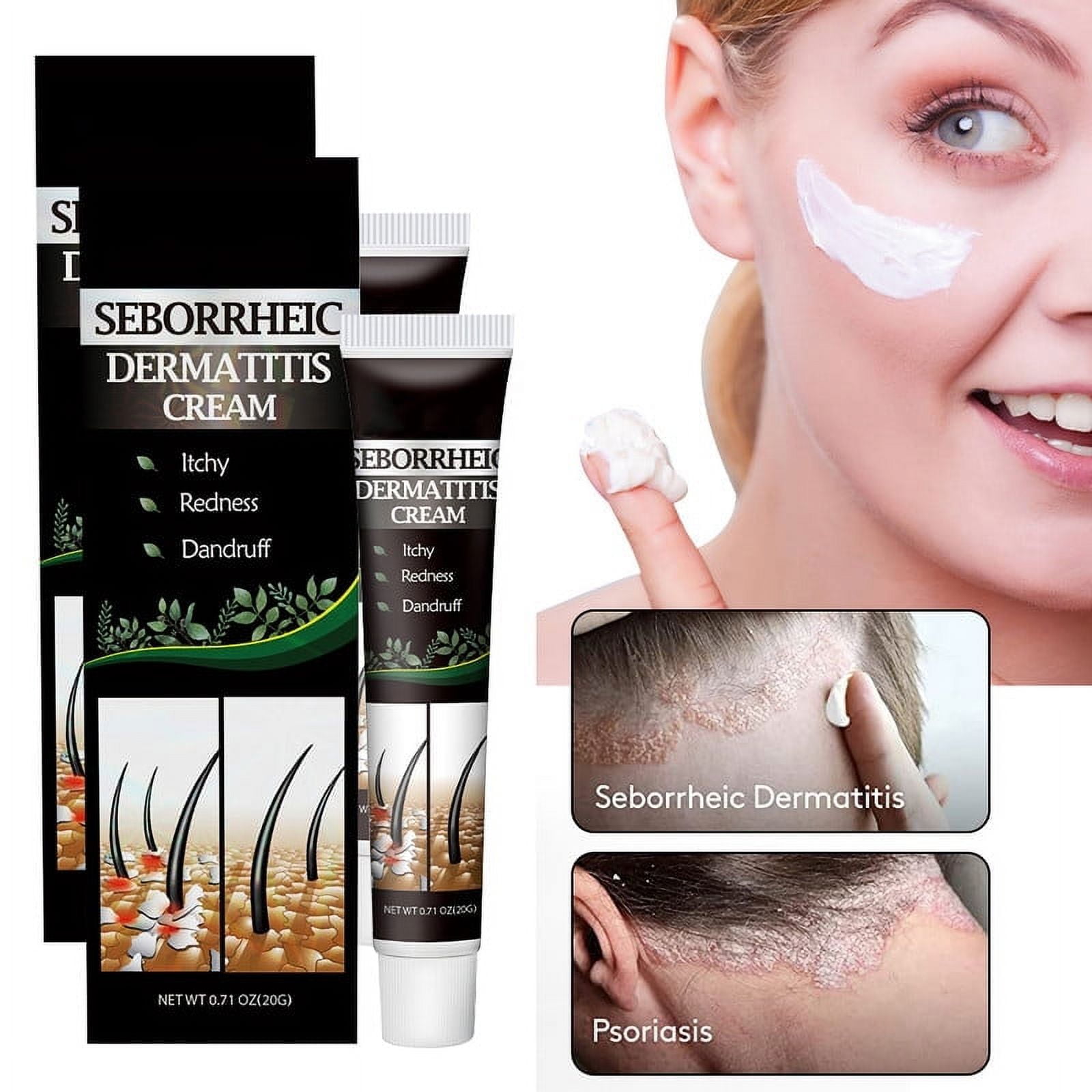 2pcs Seborrheic Dermatitis Cream,Scalp Treatment Cream,Rapid Absorption,Psoriasis &Eczema ...