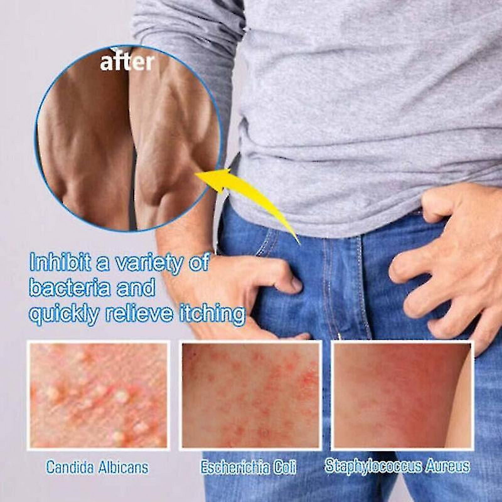 2x Men Private Intimate Cream 20g For Men Balanitis Repair Itching ...