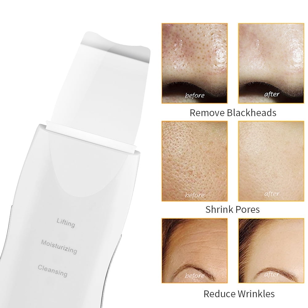 3 In 1 Electric Ultrasonic Skin Scrubber Blackhead Removal Acne ...