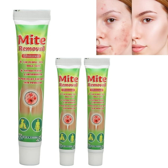 Ointment Bed Bug Bite