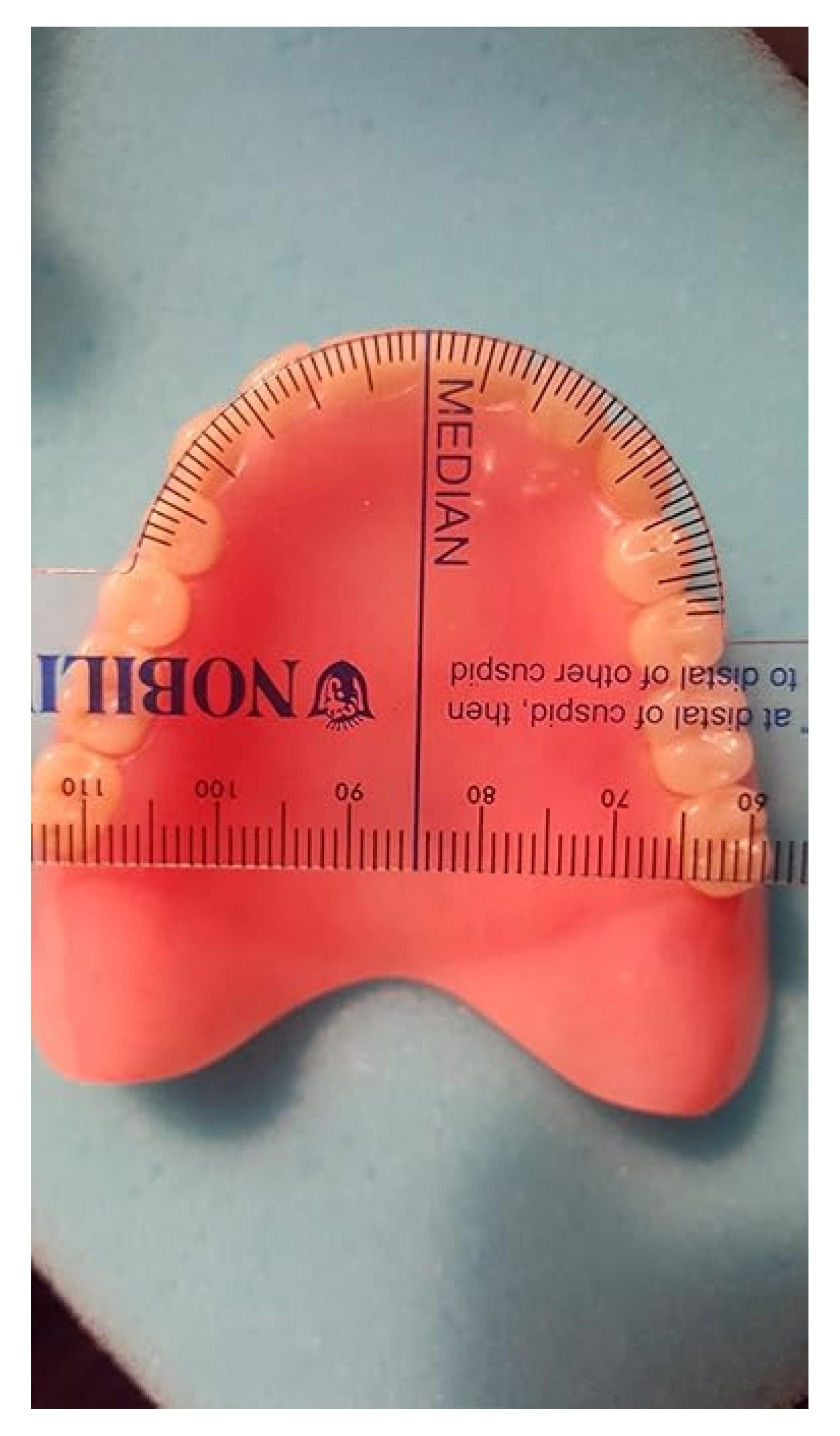 3 Pack Flexible Ruler Dentsply Denture Trubyte Millimeter Dental Lab ...