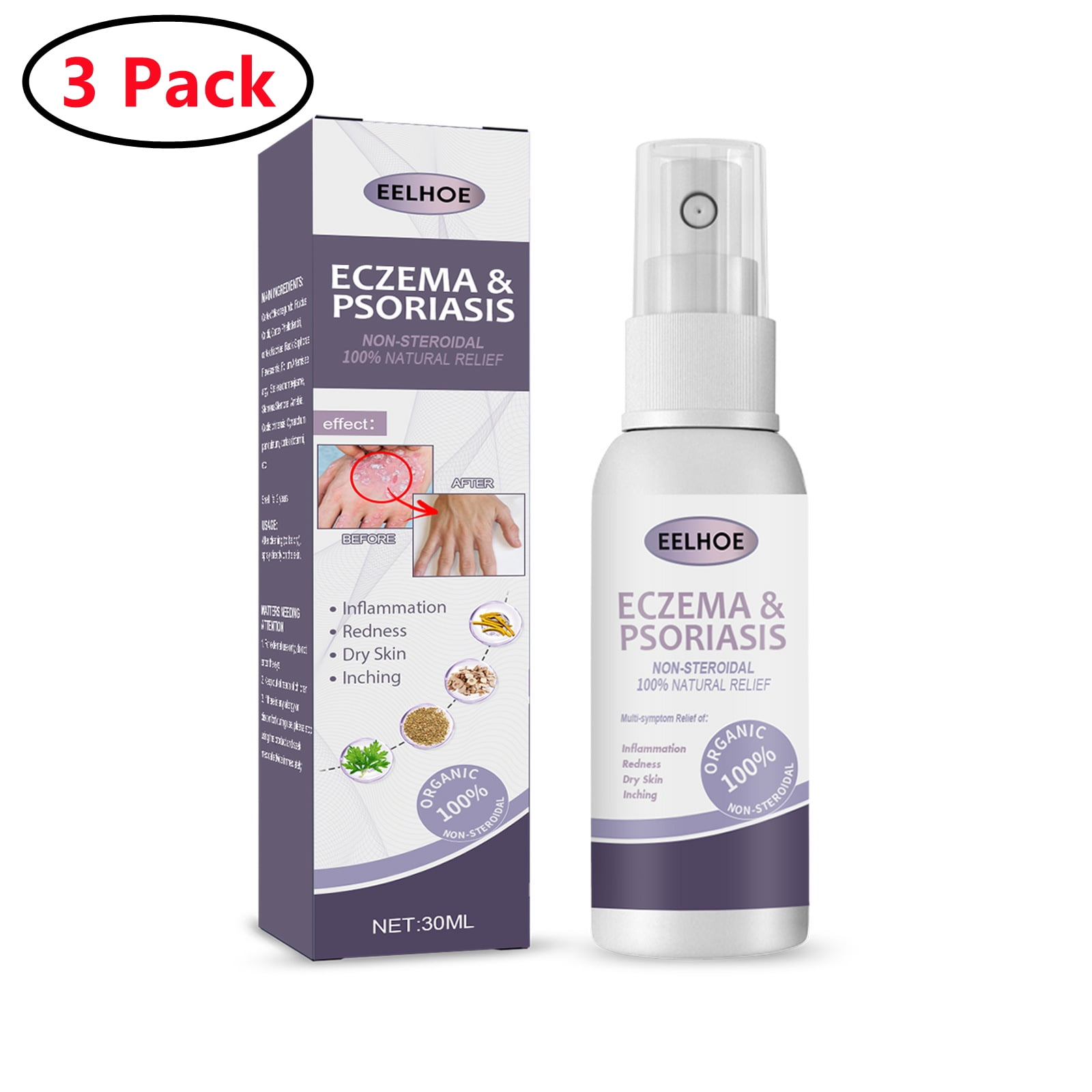 3 Pack Fungal Combat Feet Spray, Anti Fungal Infections Athlete's Foot ...
