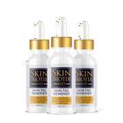 H Skin Tags Formula Can