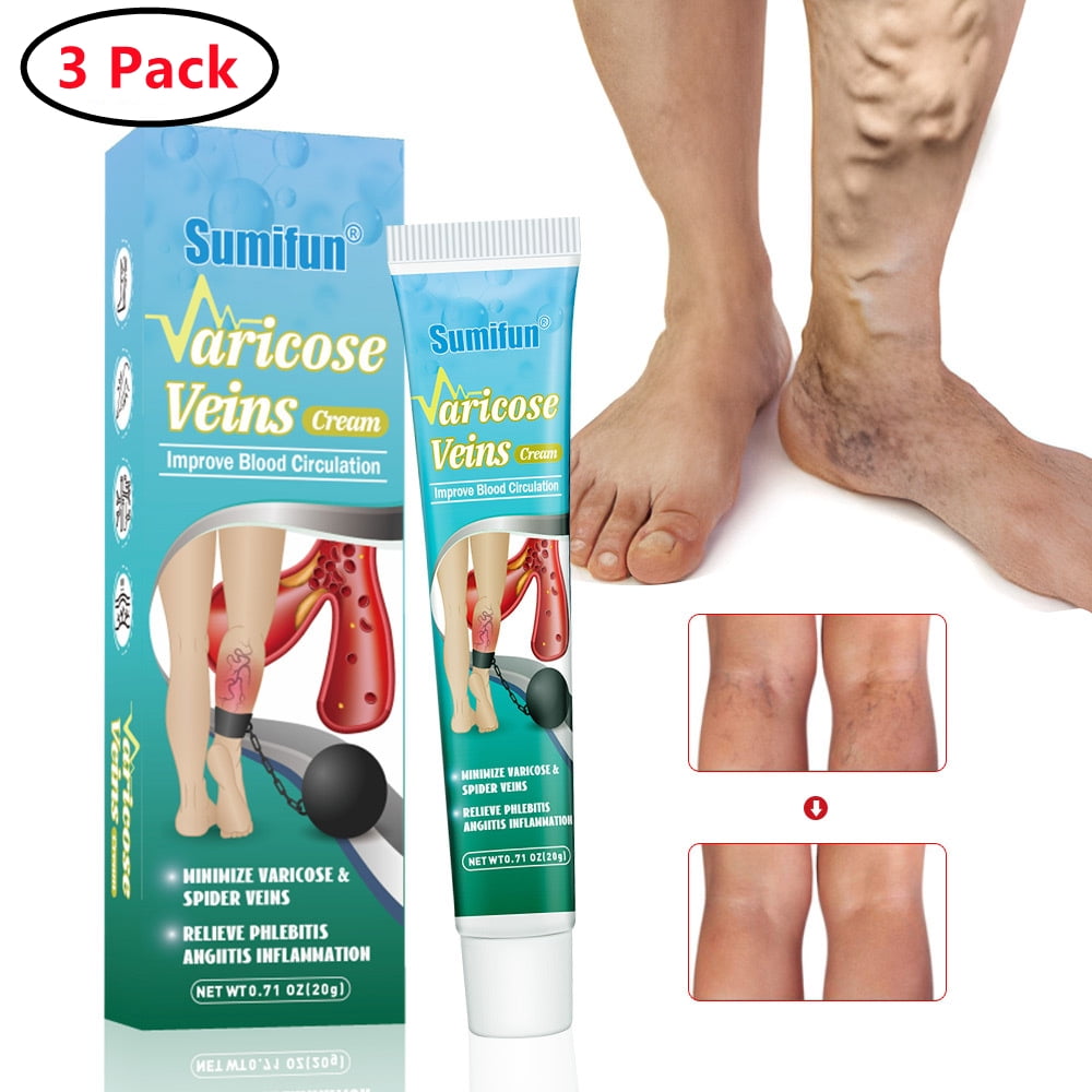 3 Pack Varicose Veins Cream, Soothing Leg Cream with Natural ...