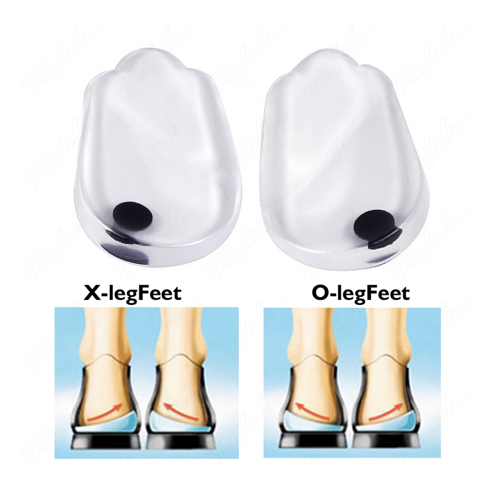 3 Pairs Magnets Silicon Orthopedic Insoles Foot Care Tool For Men Women ...