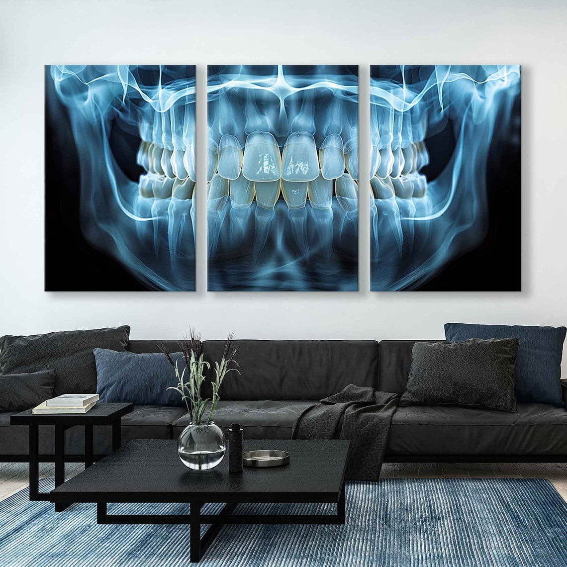 3 Pieces X-Ray Jaw Teeth Poster Teeth Prints Canvas Painting Artwork ...